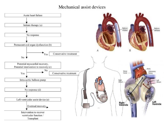 Management of acute lvf