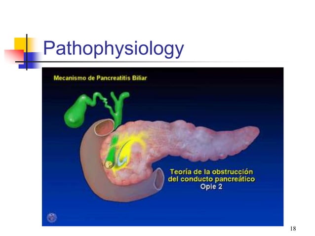 management_of_acute_pancreatitis.ppt