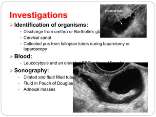 Management of acute pid | PPTX