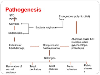 Management of acute pid | PPT