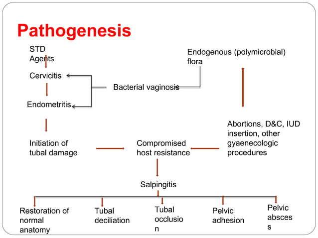 Management of acute pid | PPTX