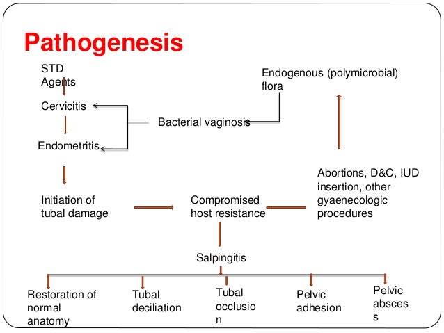 Management of acute pid