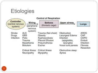 Management of acute respiratory failure.pptx