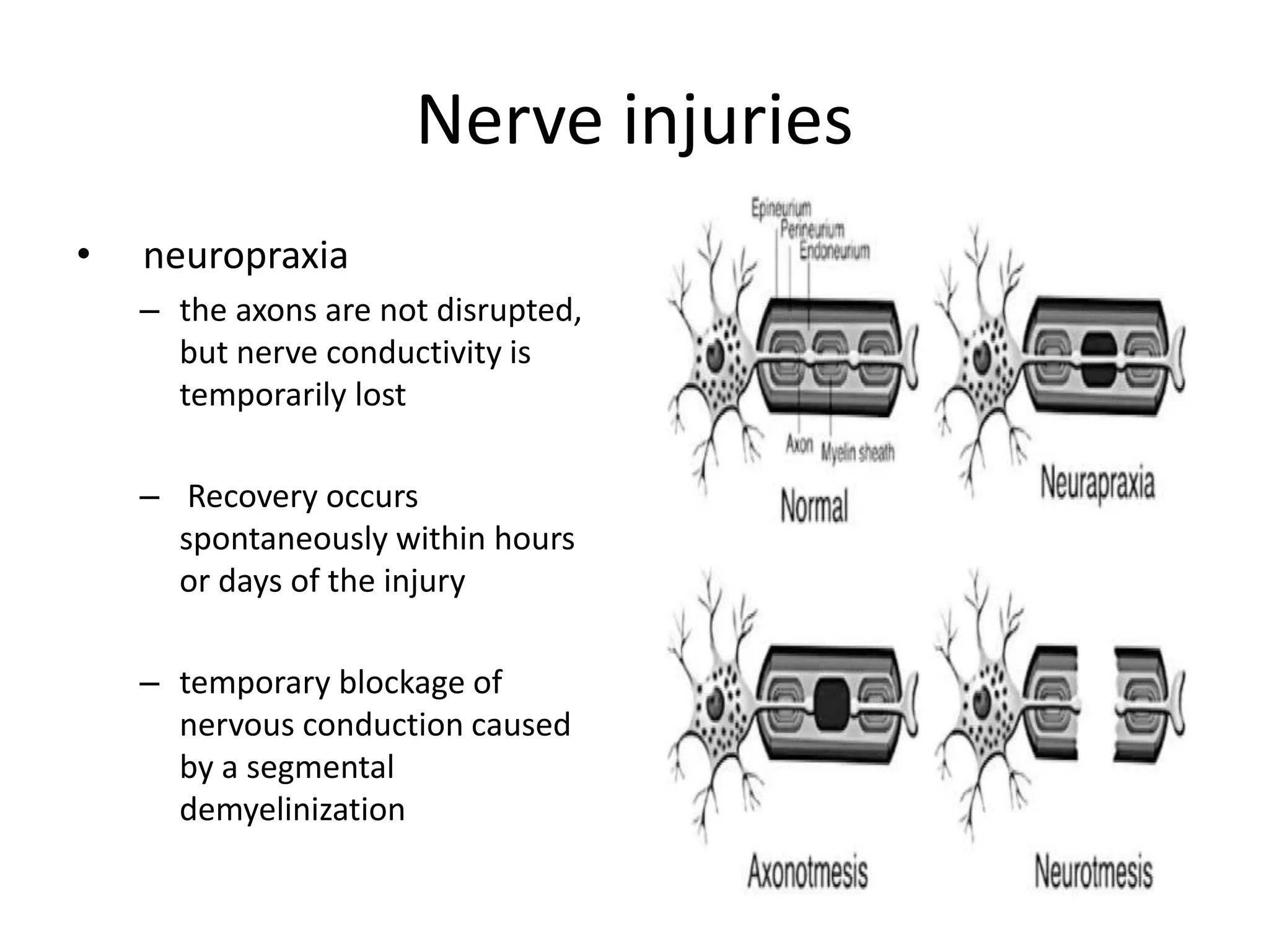 Management of acute trauma | PPT