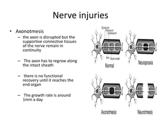 Management of acute trauma | PPTX