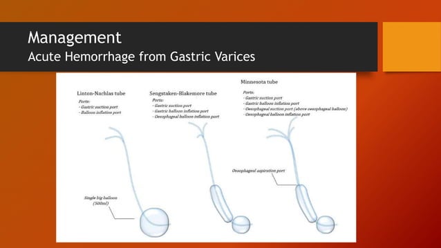 Management of Acute Variceal Bleeding | PPTX