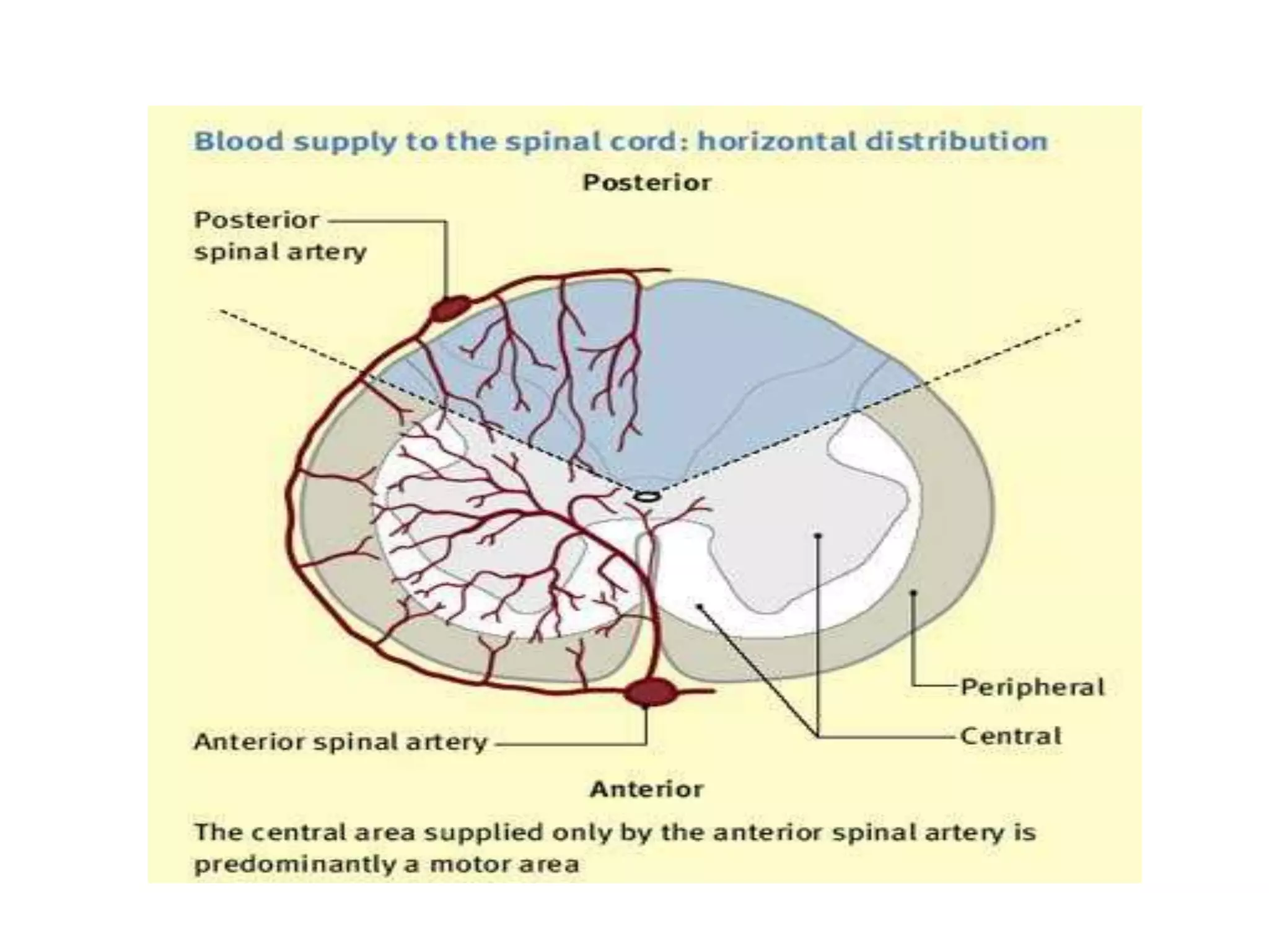 SPINAL CORD PROTECTION MANAGEMENT IN COARCTATION OF AORTA SURGERY | PPTX
