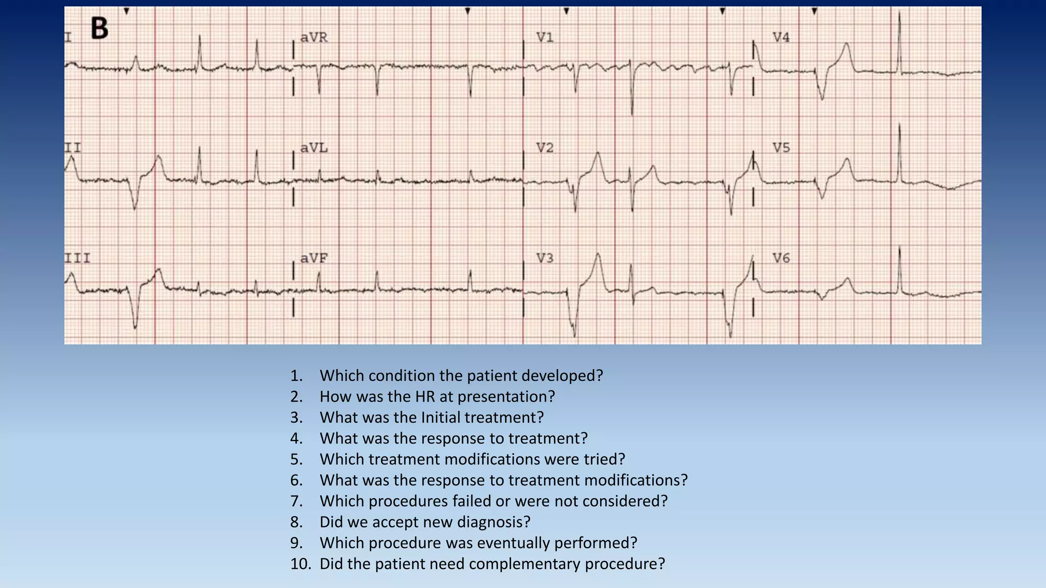 Management of atrial fibrillation (summary) | PPTX