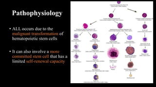 Acute Lymphoblastic Leukemia | PPTX