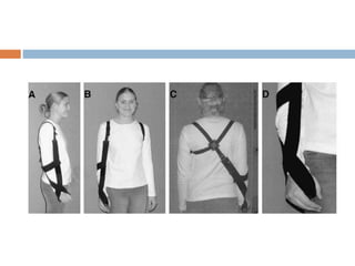 Management of ALS.pptx
