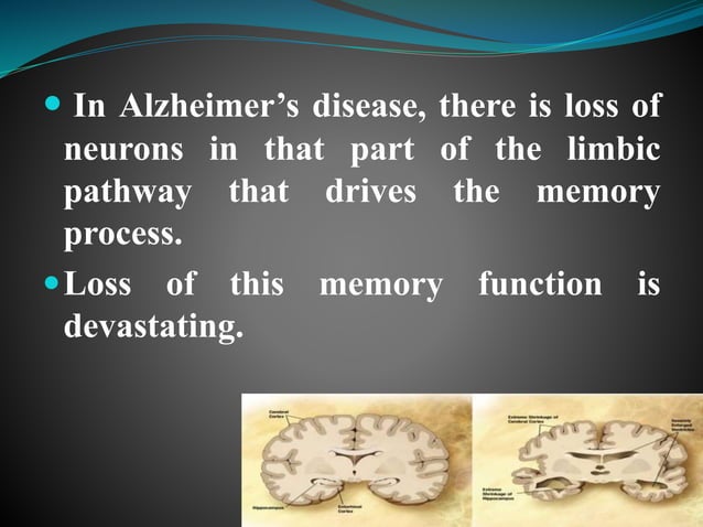 Recent advances in the management of alzheimers disease | PPT