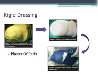 Management Of Amputation Stump.pptx