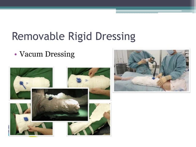 Management Of Amputation Stump.pptx