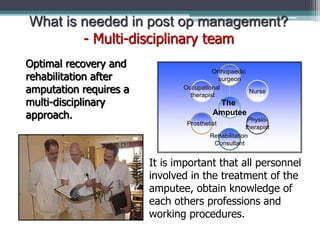 Management Of Amputation Stump.pptx