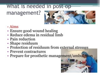 Management Of Amputation Stump.pptx