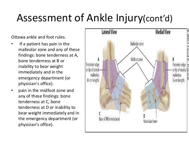 Management of ankle injuries