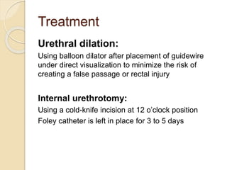 Management of anterior urethral stricture by AUA 2014 | PPT