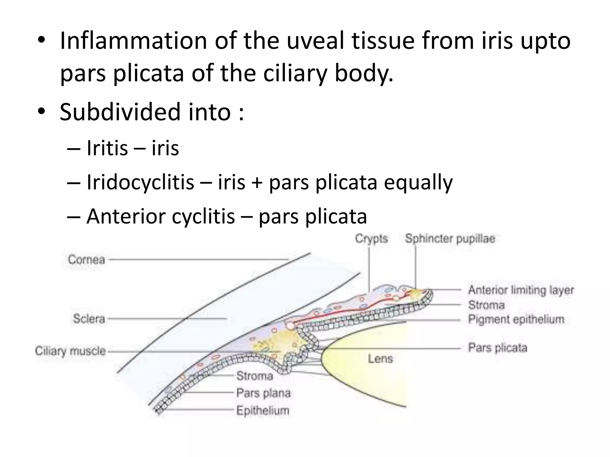 Management of Anterior uveitis.pptx
