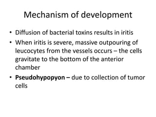 Management of Anterior uveitis.pptx