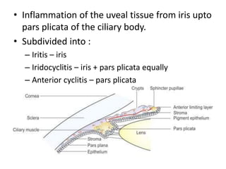 Management of Anterior uveitis.pptx