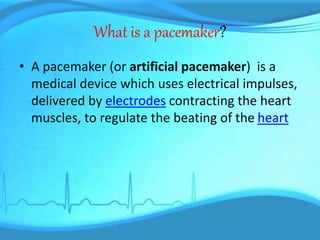 Management of a patient with pacemaker | PPTX