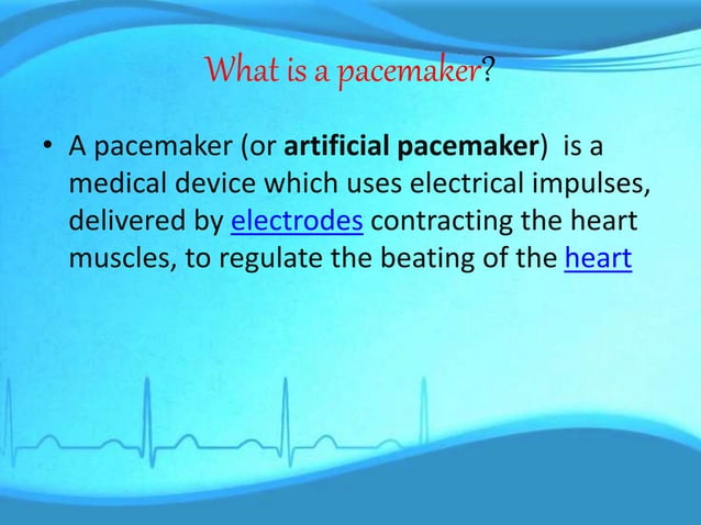 Management of a patient with pacemaker | PPTX
