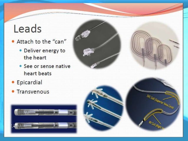 Management of a patient with pacemaker | PPTX