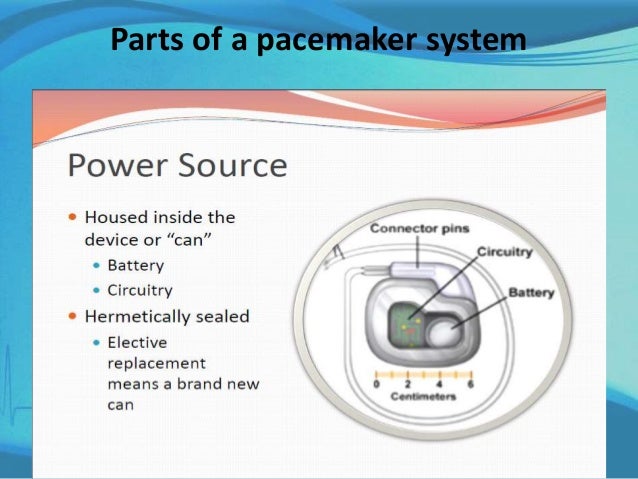 Management of a patient with pacemaker