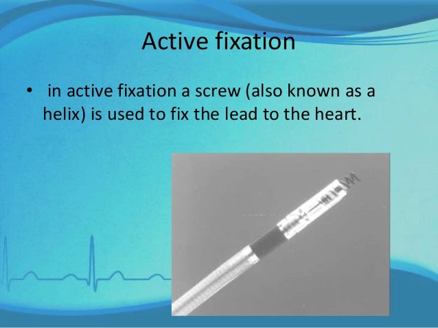 Management of a patient with pacemaker