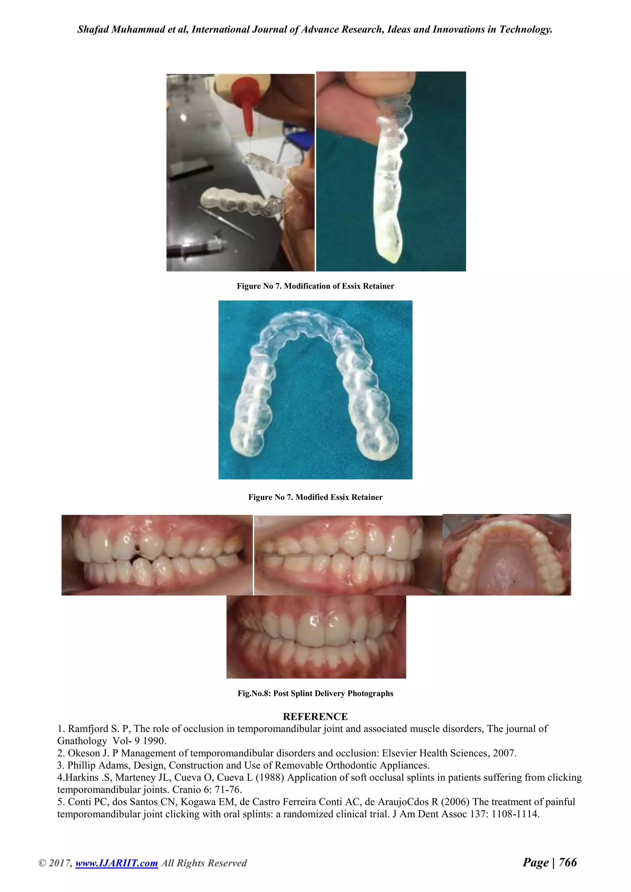 Management of a patient with temporomandibular disorder and trauma from ...