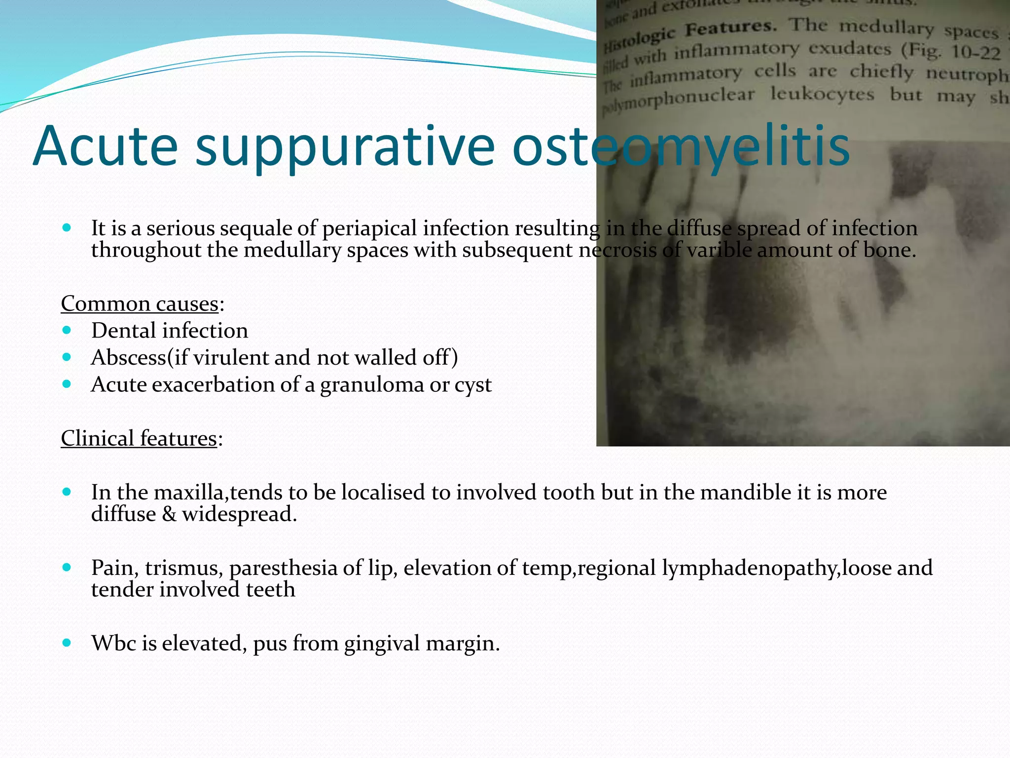 Management of apical lesions | PPTX