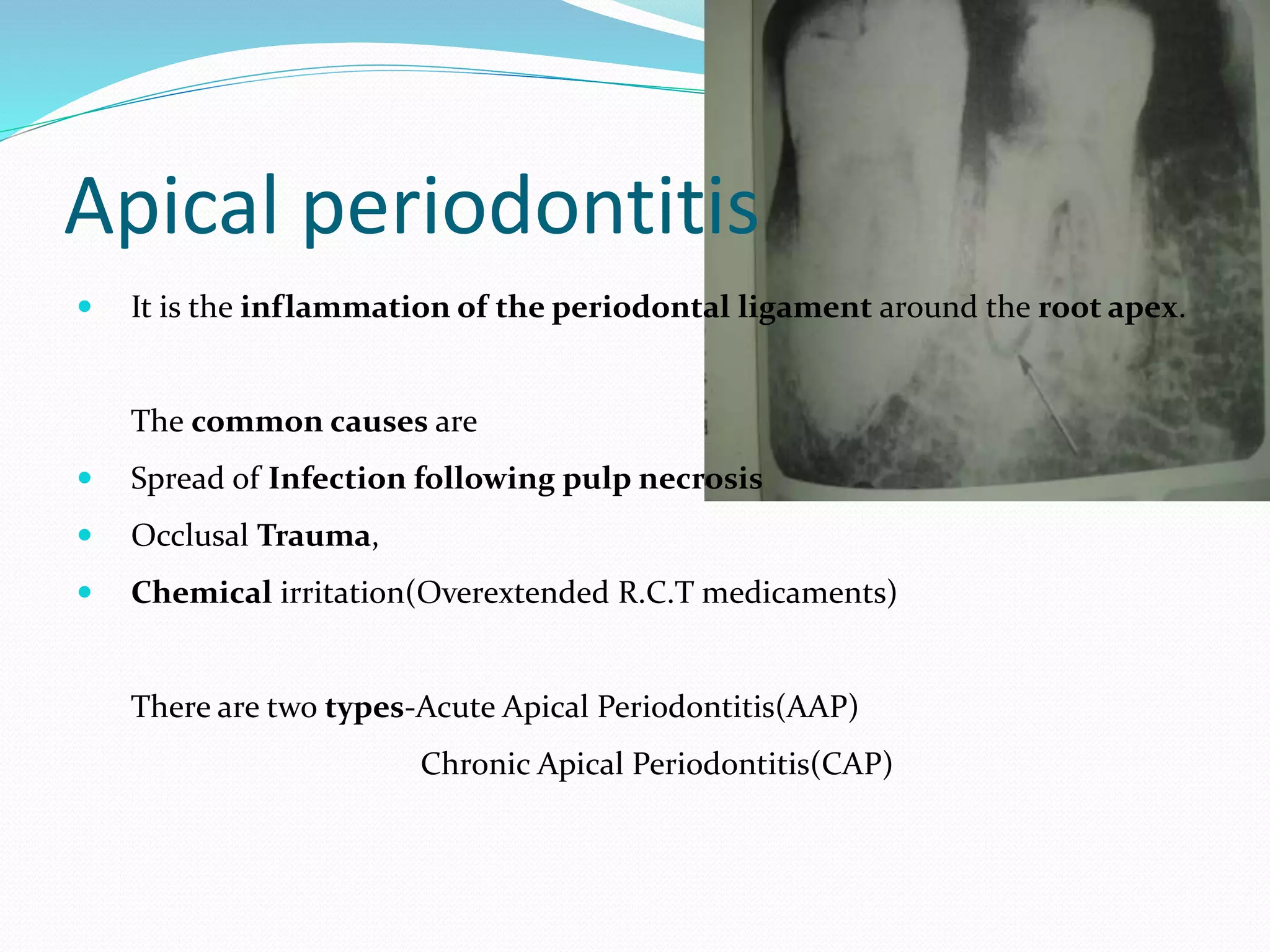Management of apical lesions | PPTX