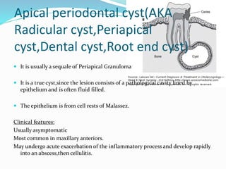 Management of apical lesions | PPTX