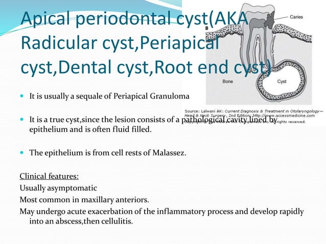 Management of apical lesions | PPTX