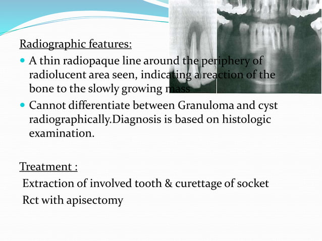 Management of apical lesions | PPTX