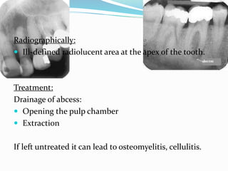 Management of apical lesions | PPTX