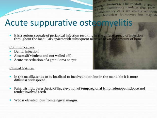 Management of apical lesions | PPTX