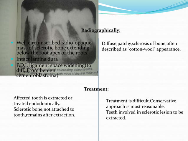 Management of apical lesions | PPTX