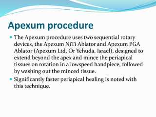Management of apical lesions | PPTX