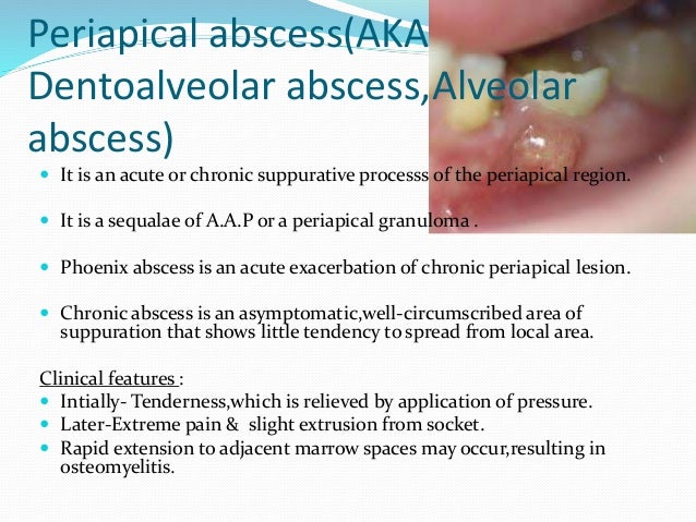 Management of apical lesions