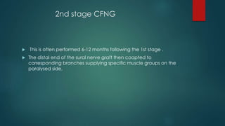 Management of bells palsy | PPTX