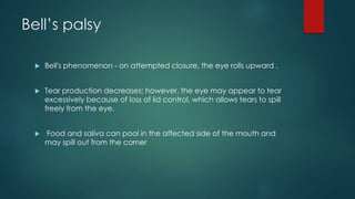 Management of bells palsy | PPTX