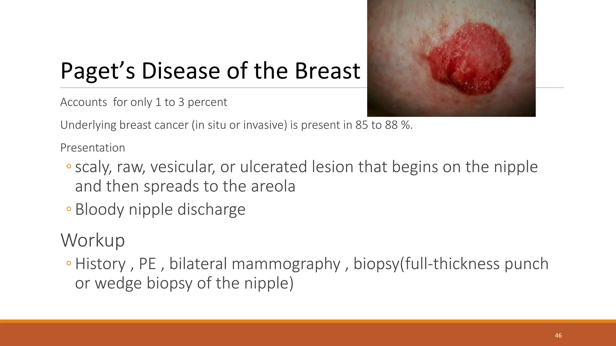 management of benign and malignant disease of breast.pptx