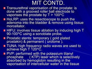 Management of bening prostatic hyperplasia | PPT