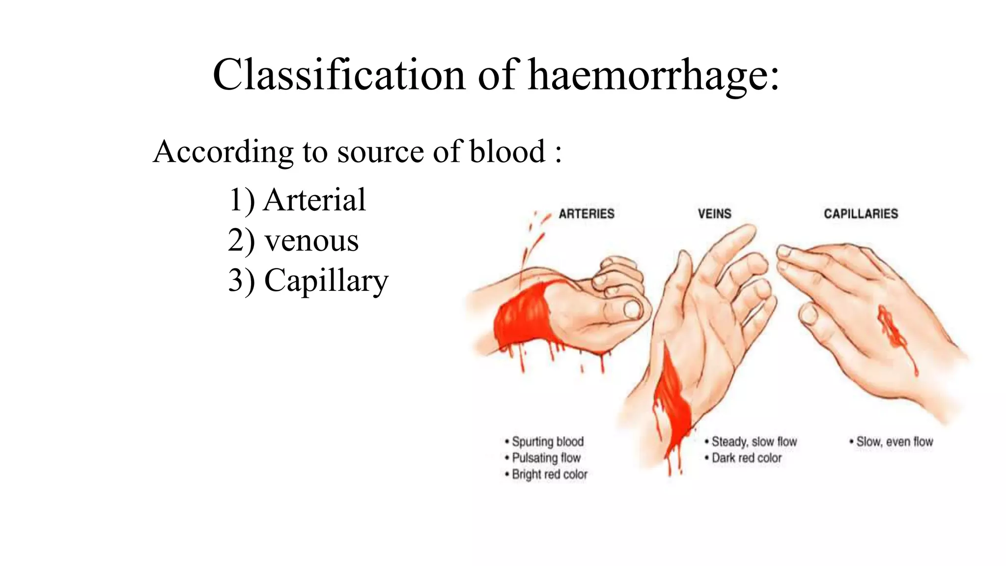 Management of bleeding | PPTX