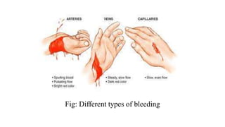 Management of bleeding | PPTX