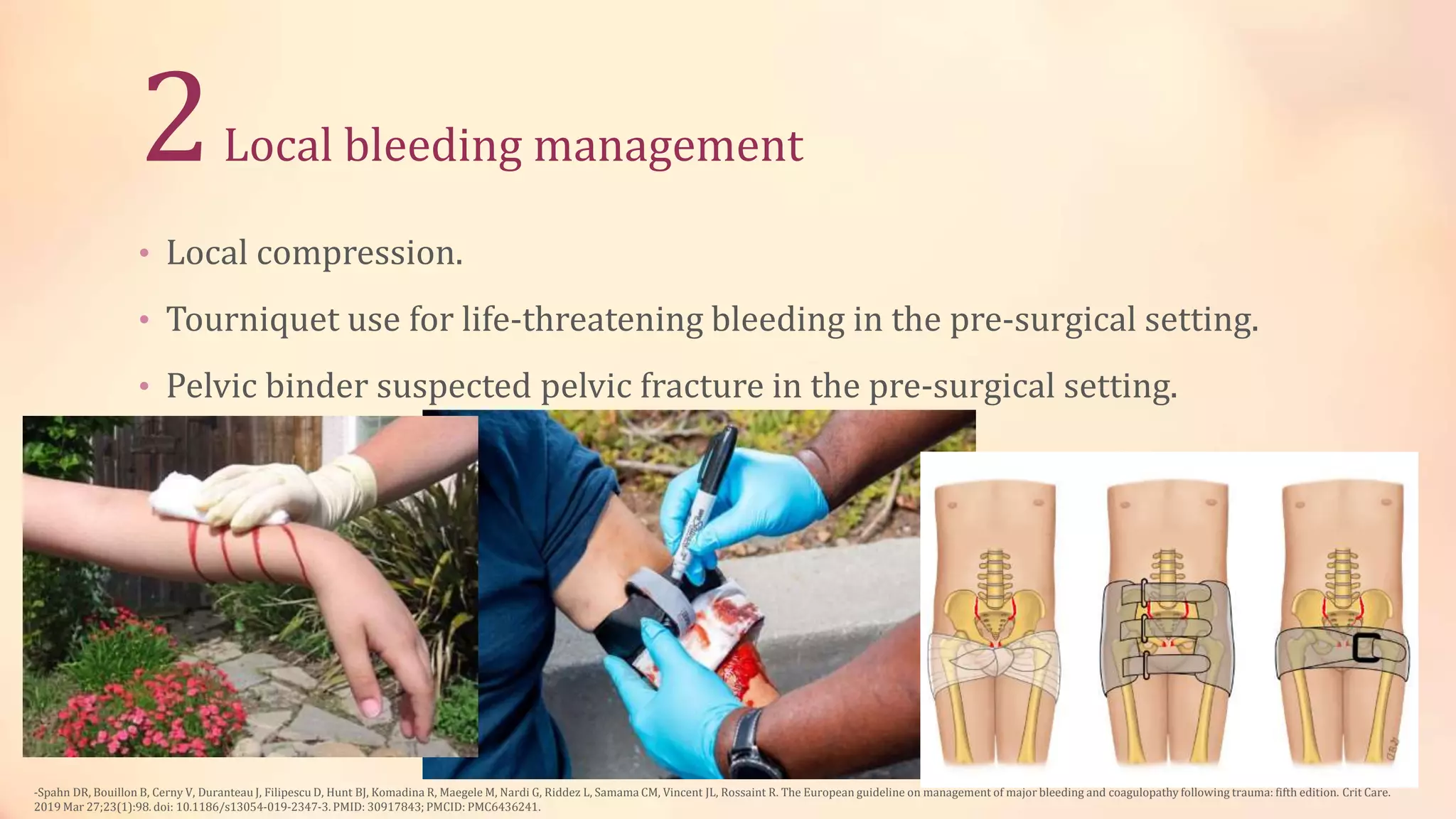 Management of bleeding in trauma | PPTX