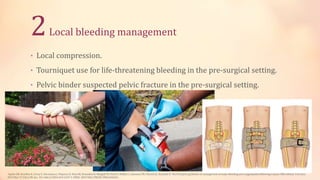 Management of bleeding in trauma | PPTX