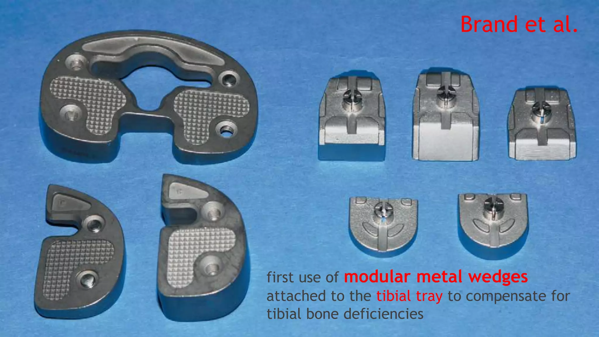 TOTAL KNEE REPLACEMENT (TKR) correction of varus and tibial bone defect ...
