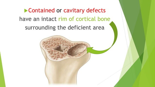 TOTAL KNEE REPLACEMENT (TKR) correction of varus and tibial bone defect ...